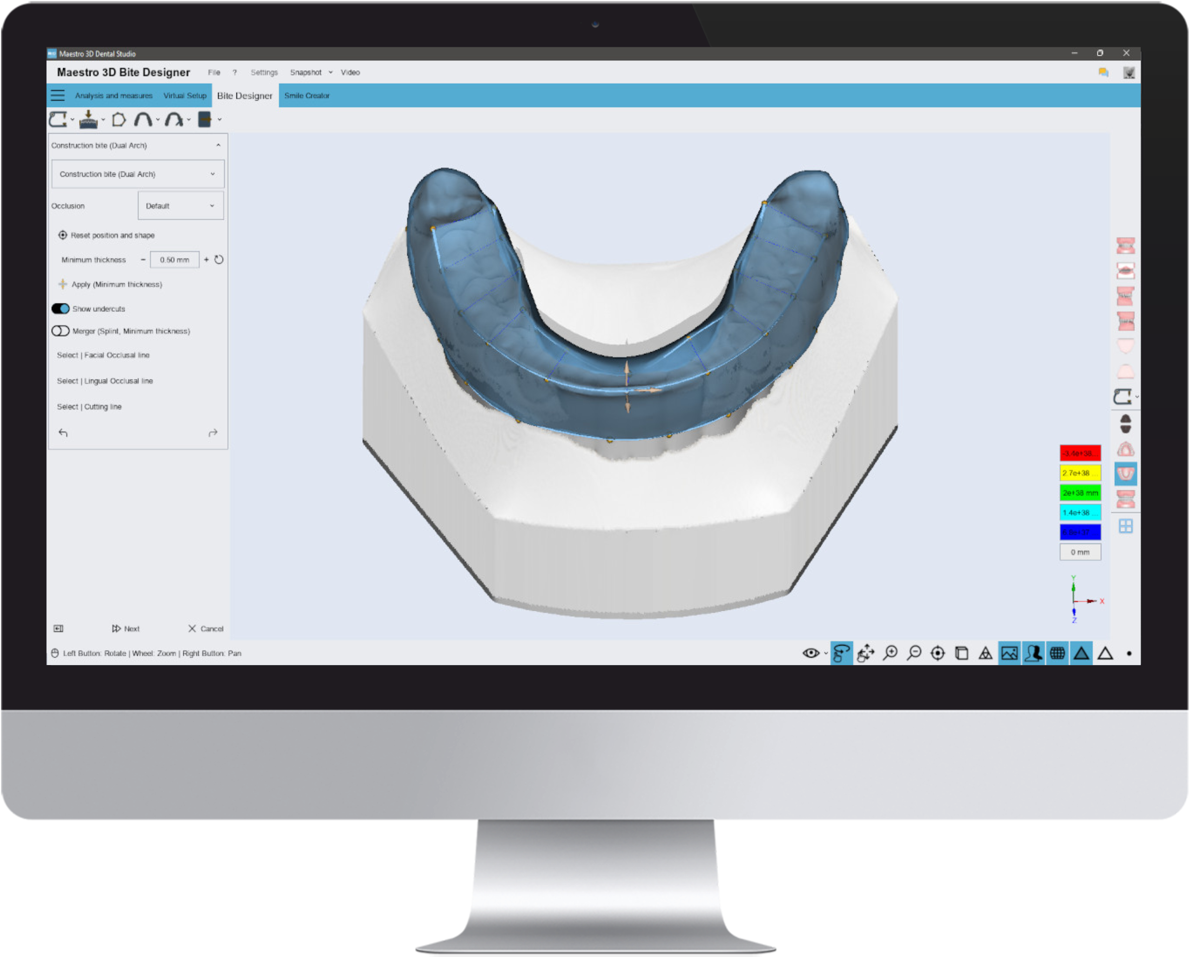 Bite Splint Software – OBLU HEALTHCARE Bite Splint Software – OBLU HEALTHCARE