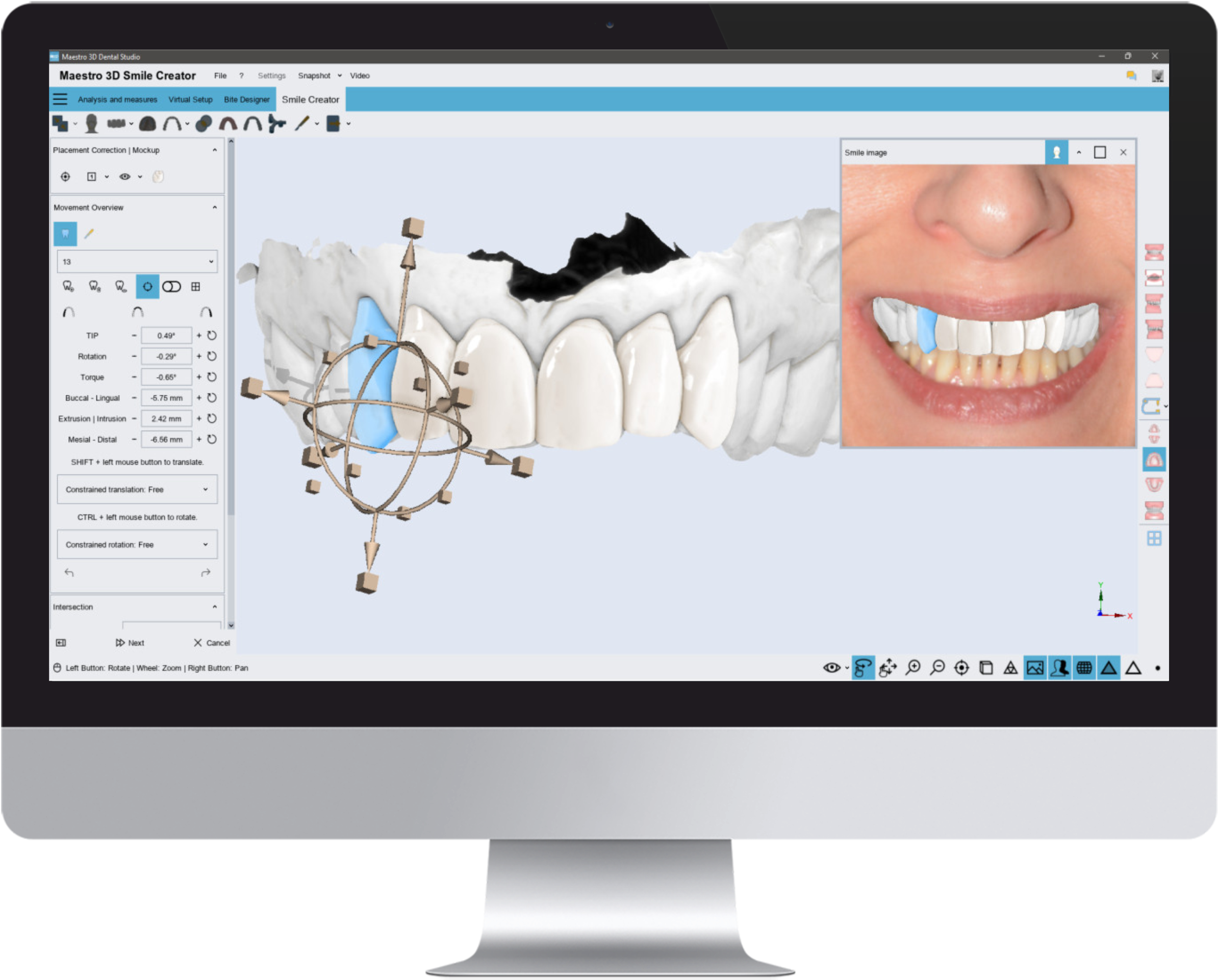 Smile Creator Software – OBLU HEALTHCARE Smile Creator Software – OBLU HEALTHCARE